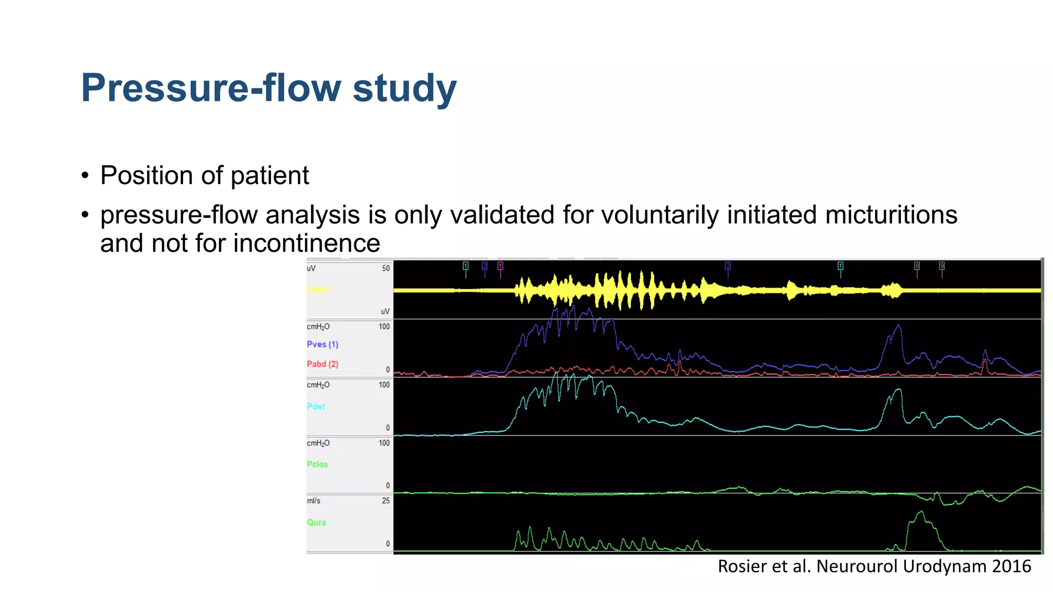 REPORTING URODYNAMIC STUDY | PPTX