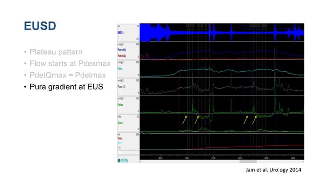 REPORTING URODYNAMIC STUDY | PPTX