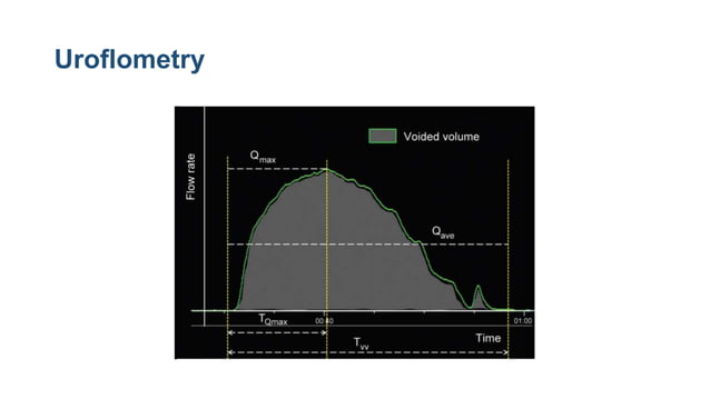 REPORTING URODYNAMIC STUDY | PPTX