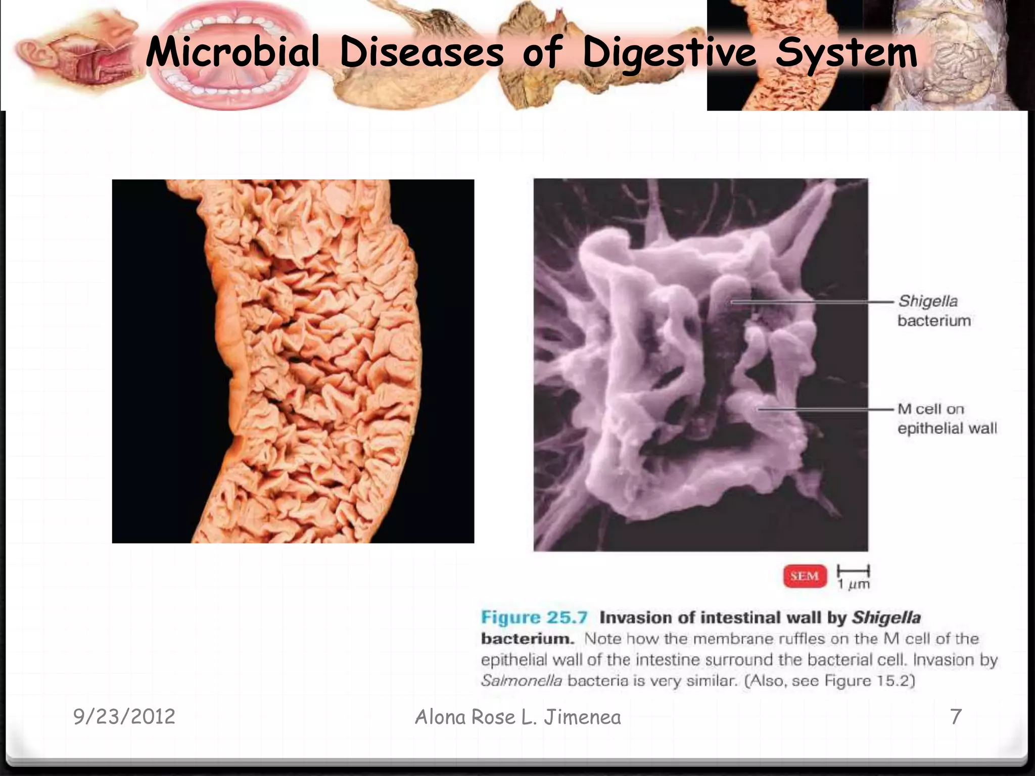 microbiology | PPTX | Digestive Disorders | Diseases and Conditions