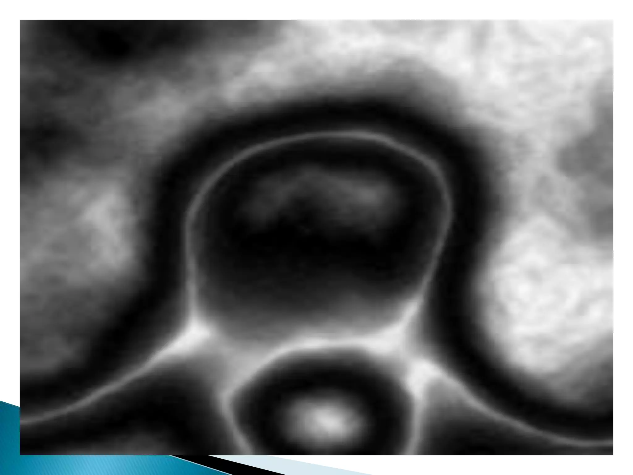 Meiosis Pptx