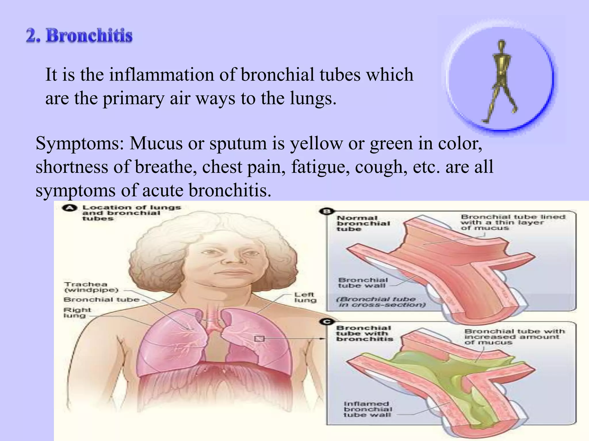 Report in Respiratory System | PPTX
