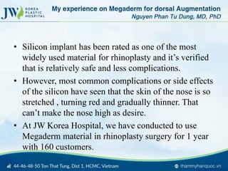 My experience on Megaderm for dorsal Augmentation | PPT