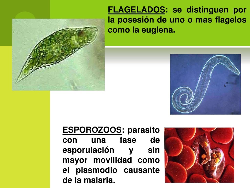 Protista Ejemplos