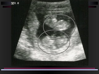 Human reproduction lesson 8 | PPT