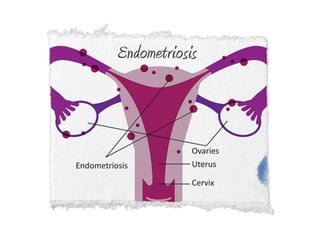Reproductive-System.ppt