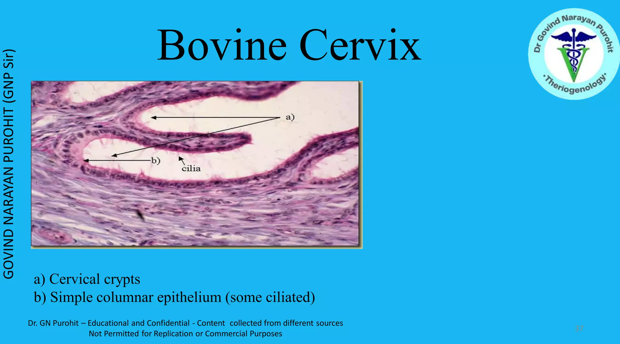 Reproductive anatomy of females ii tubular structures (1) | PDF