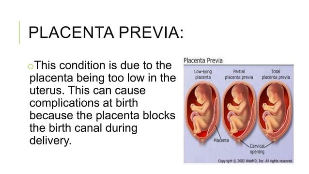 Reproductive and pregnancy complications | PPT