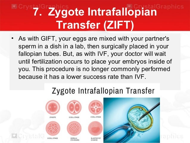 Zygote Intrafallopian Transfer Zygote Intrafallopian Transfer ...