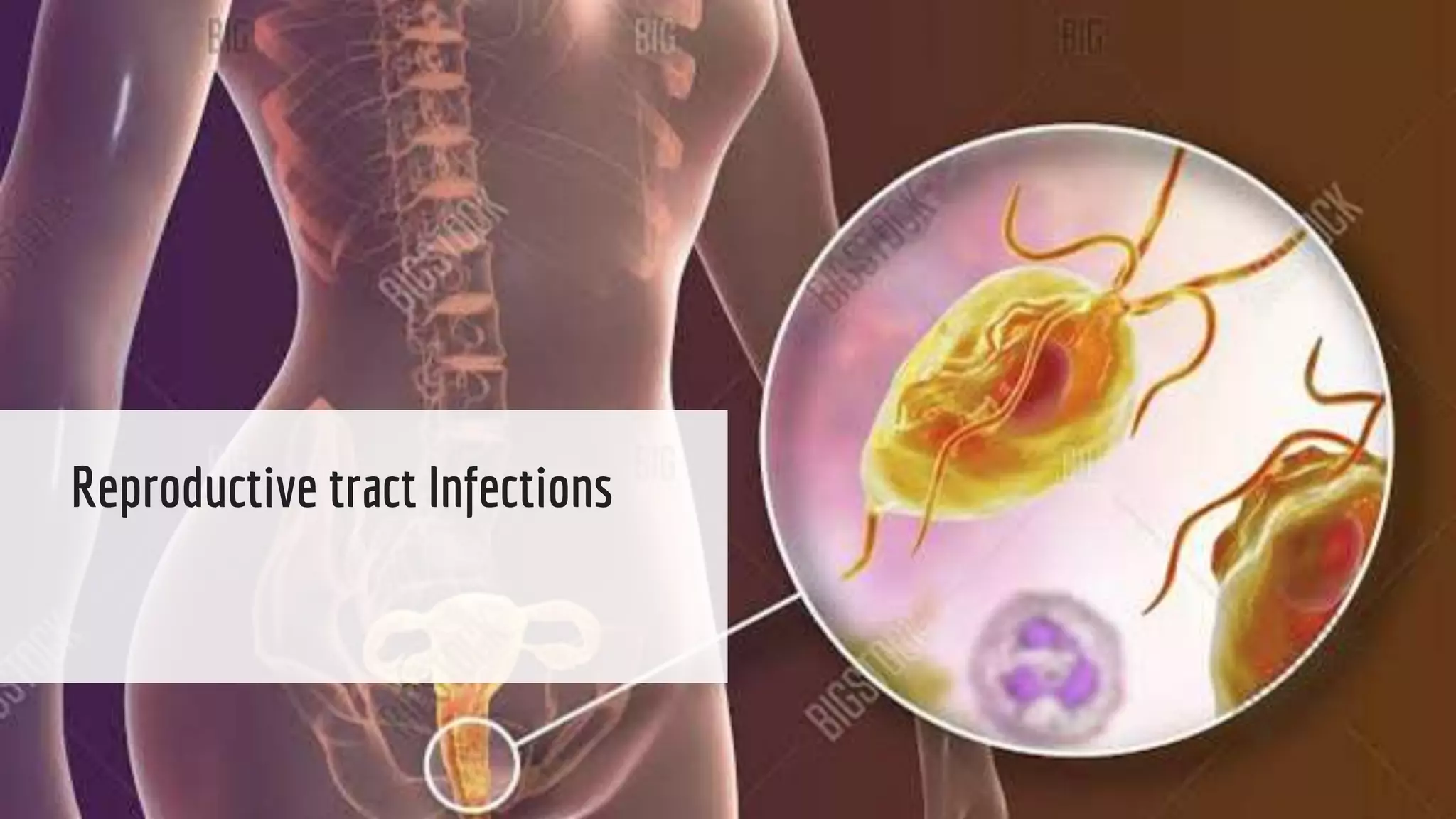 Reproductive Disorder-Lecture001 _AH_ Rabia.pptx