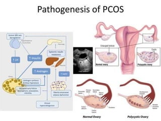 REPRODUCTIVE ENDOCRINOLOGY1.pptx OBS/GYN | PPTX