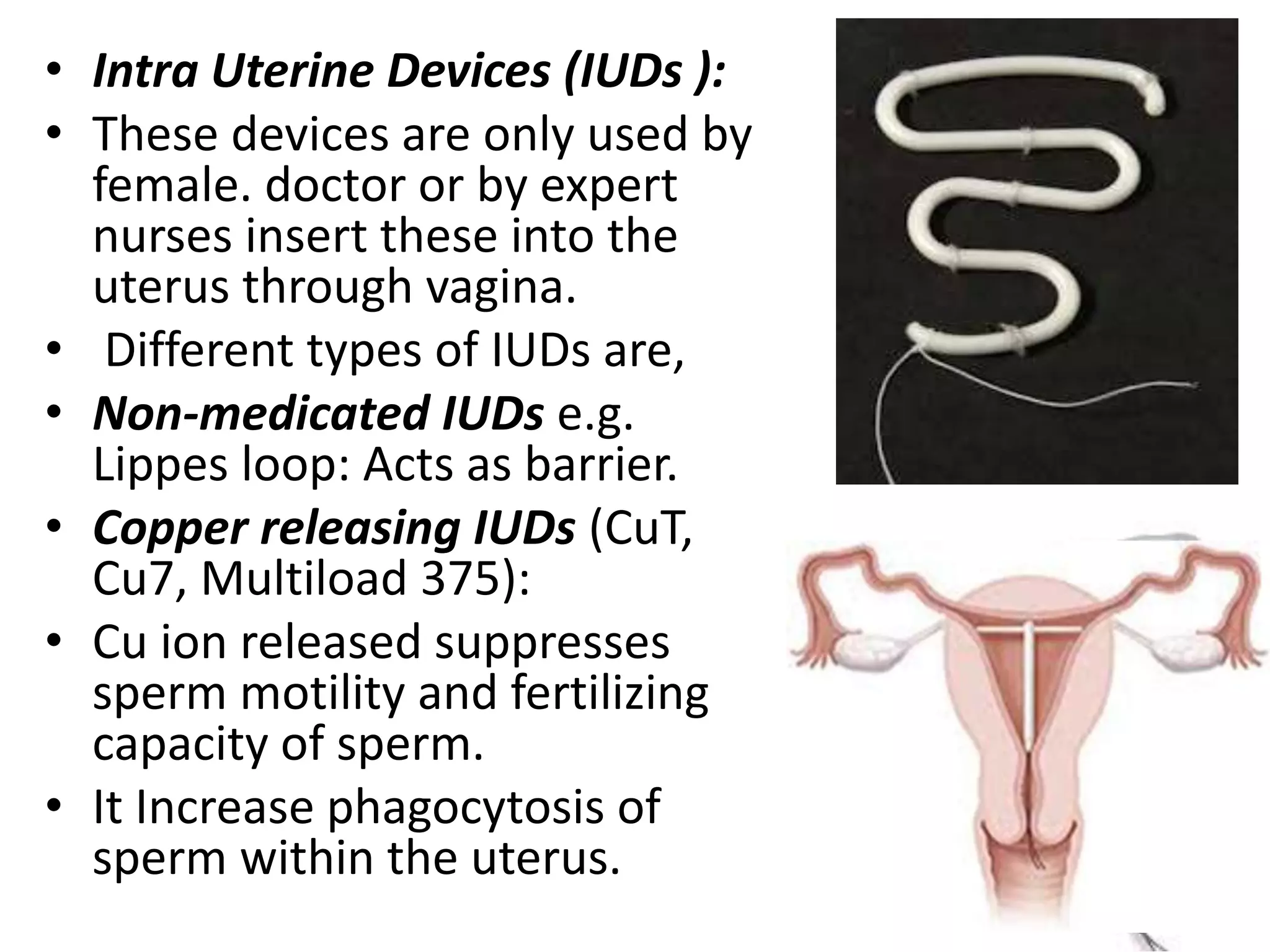 Chapter 4. Reproductive health | PPTX