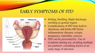 Reproductive health std's | PPT