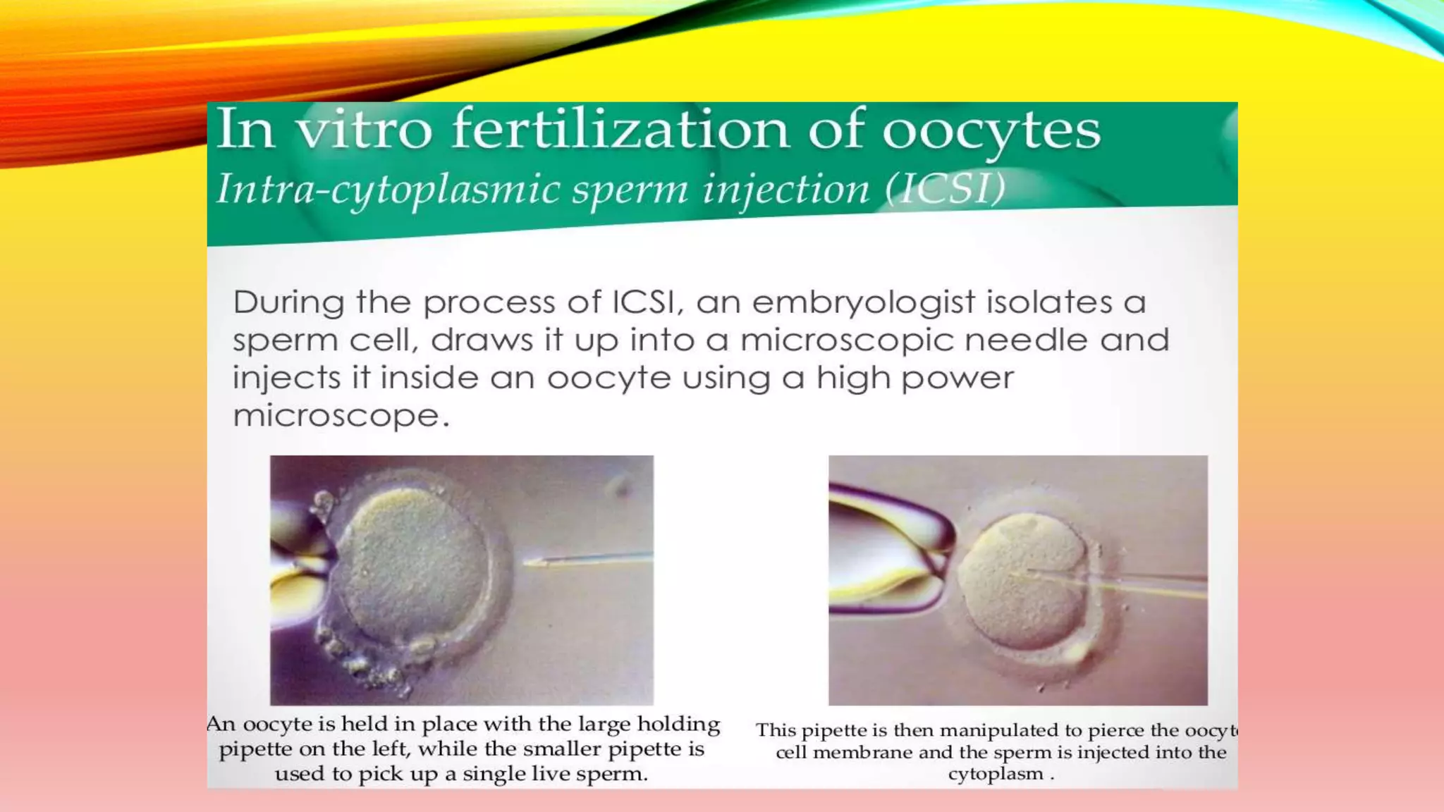 Reproductive Health Awareness Pptx