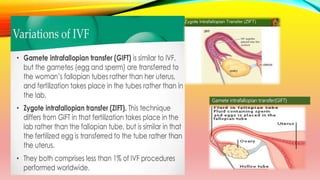 Reproductive health awareness | PPTX