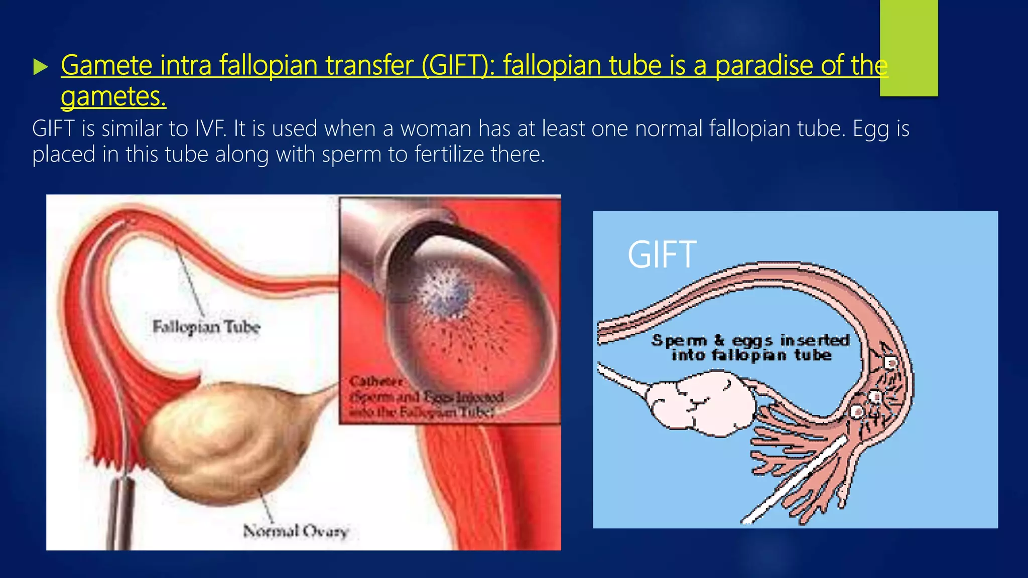 Reproductive medicine & its medico legal importance | PPTX