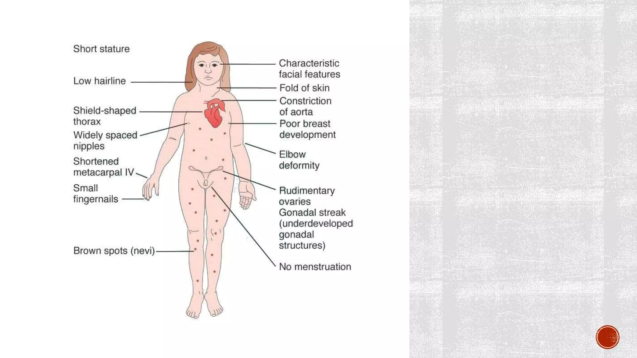 Sex Differentiation And Development Pptx Reproductive Health