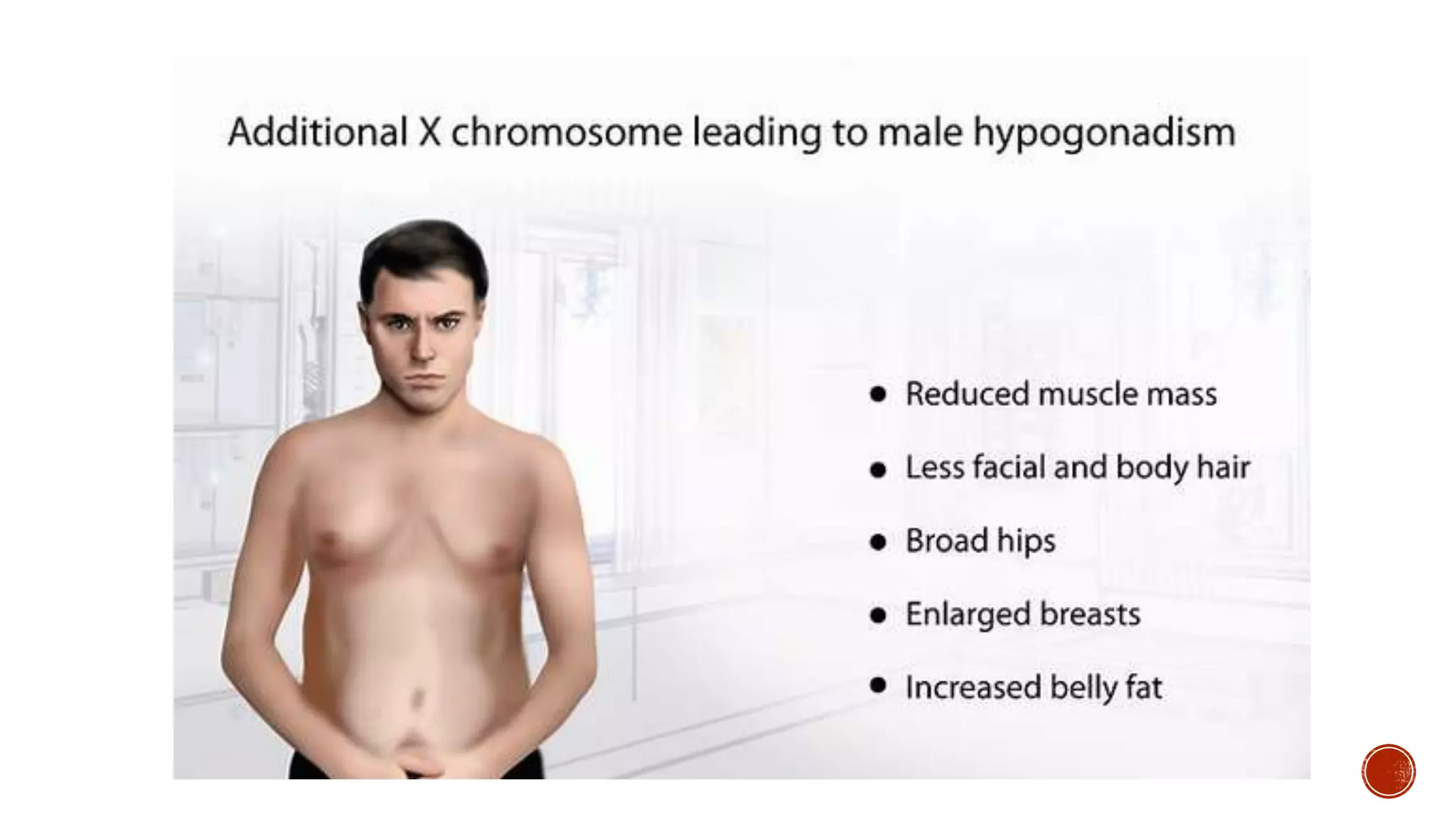 Sex Differentiation And Development Pptx