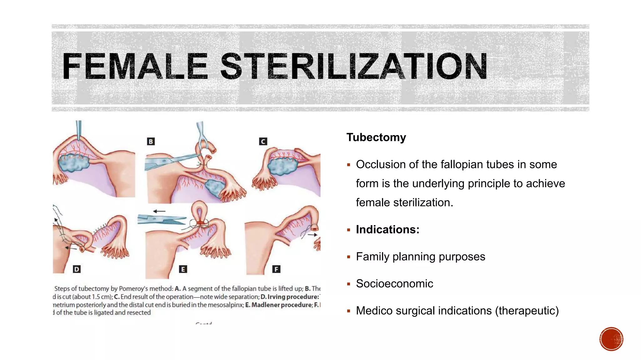 Contraception | PPTX
