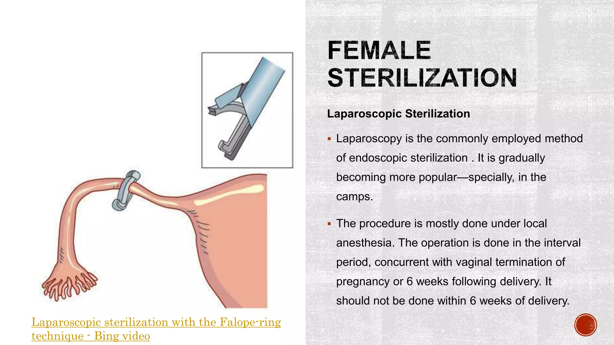 Contraception | PPTX | Birth Control | Reproductive Health