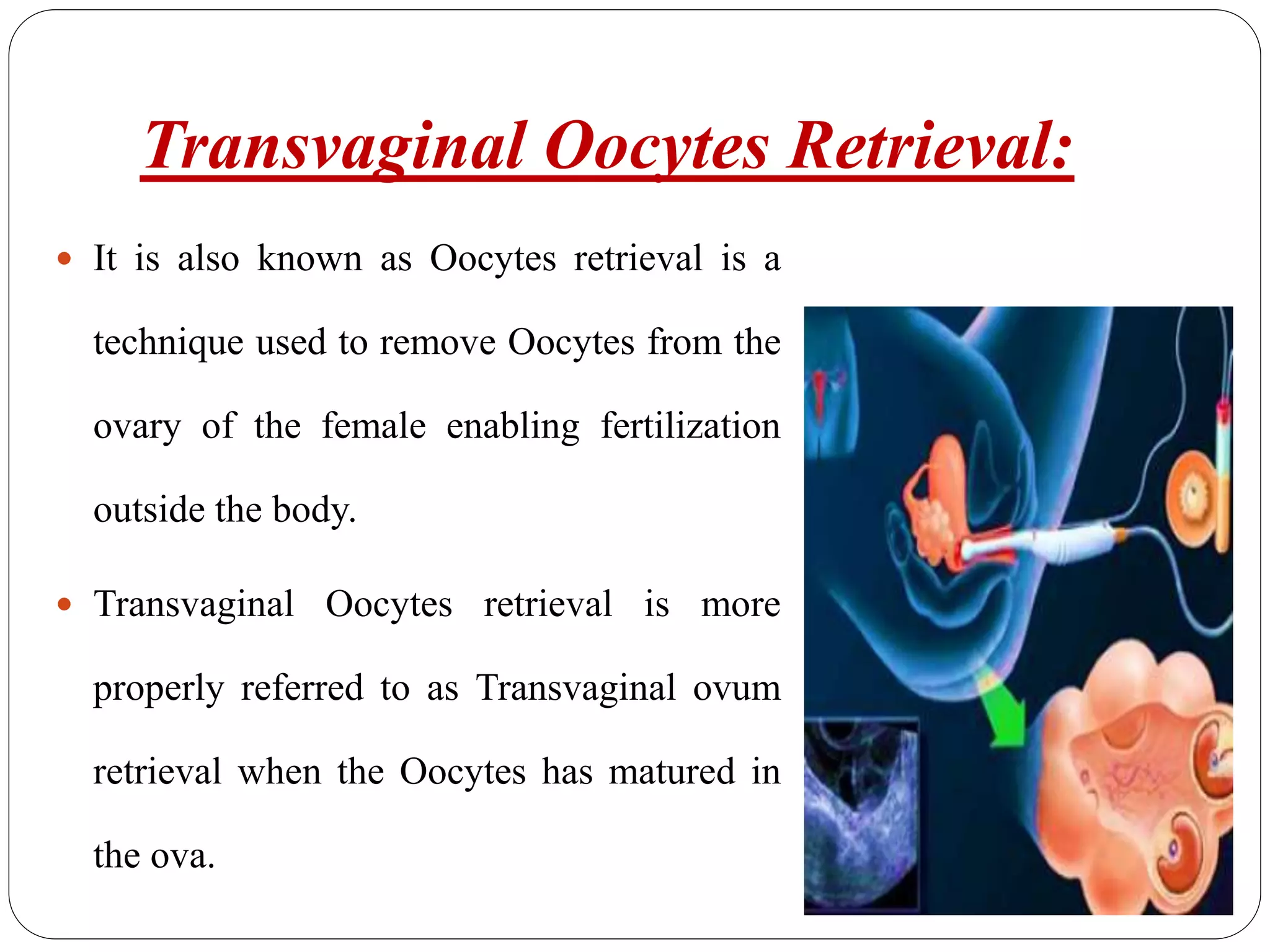 Reproductive system and its Classification | PPT