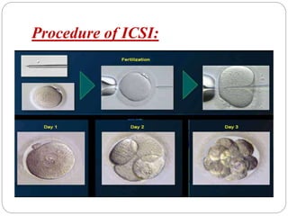 Reproductive system and its Classification | PPT