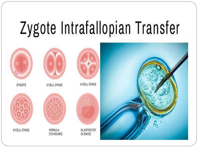 Reproductive system and its Classification | PPT