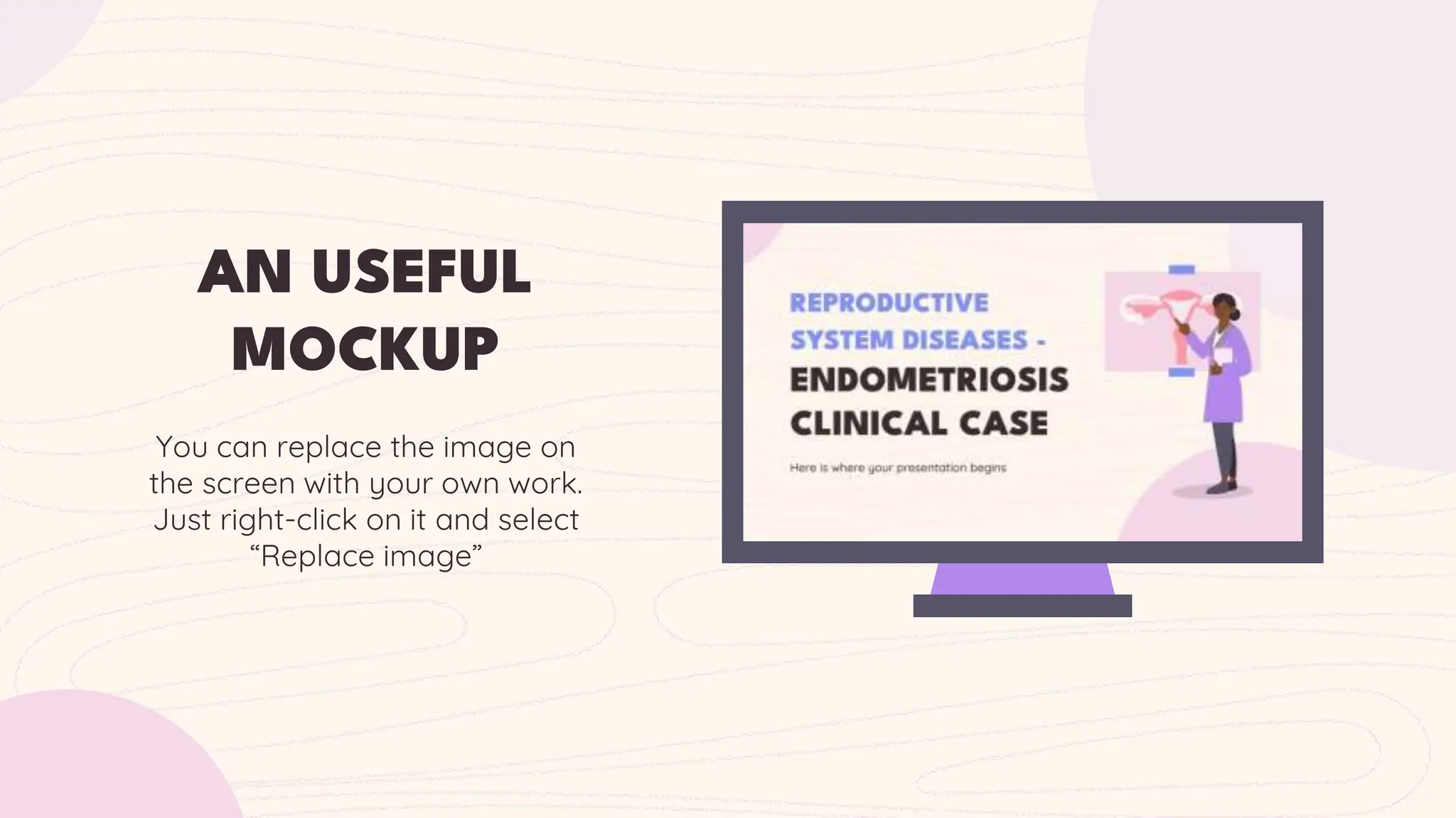 Reproductive System Diseases - Endometriosis Clinical Case by Slidesgo ...
