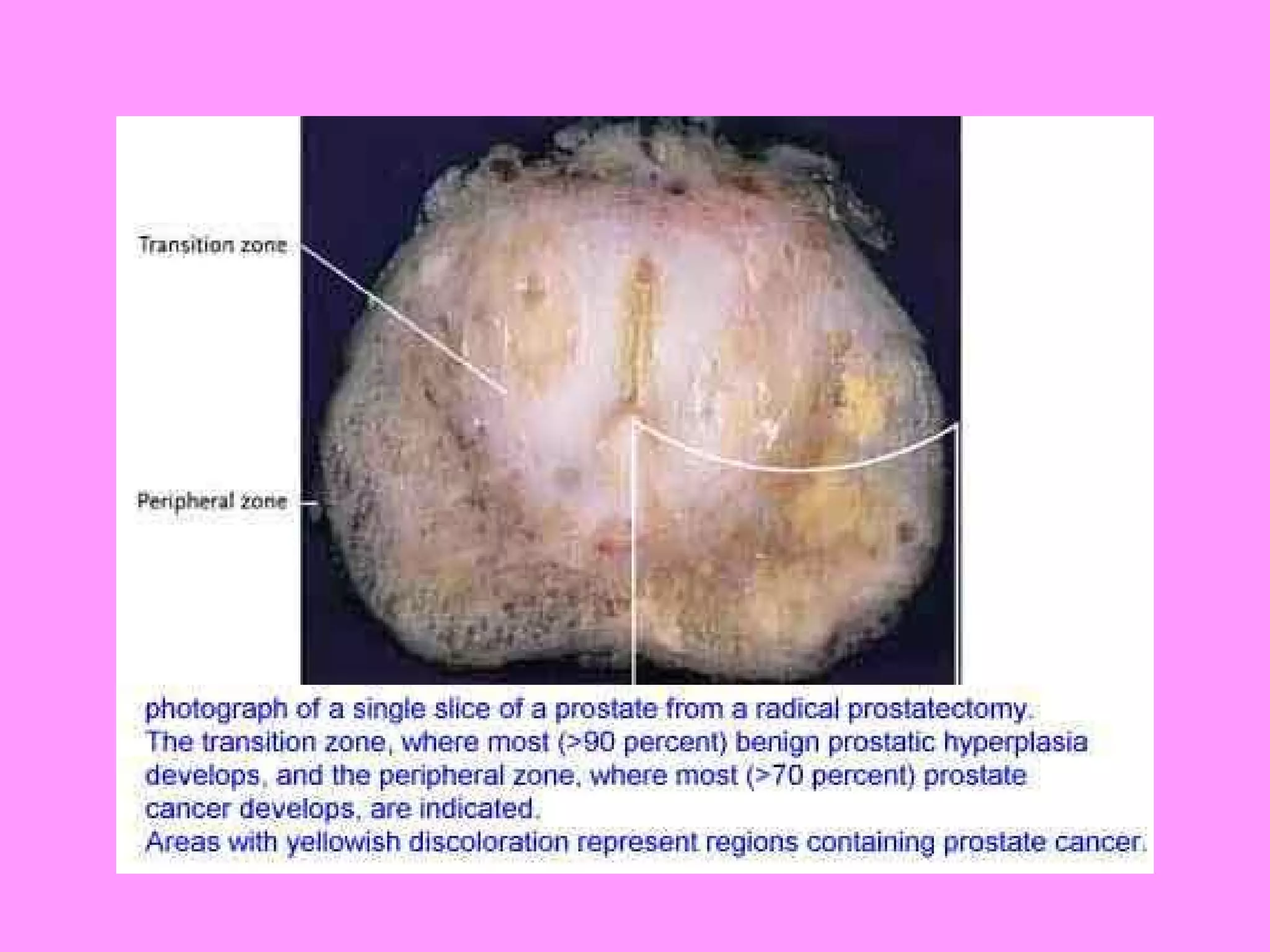 Reproductive System Disorders | PPT