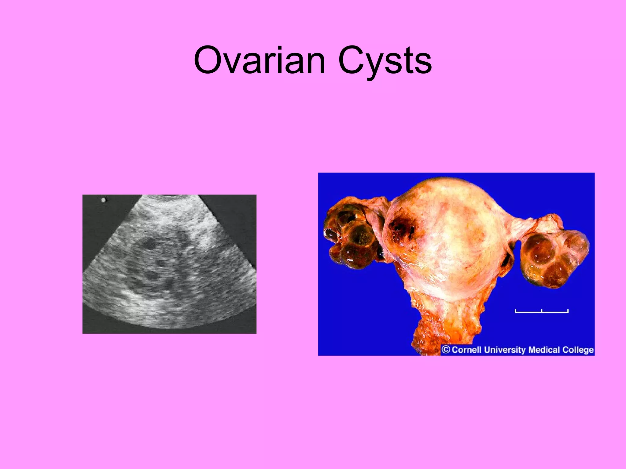 Reproductive System Disorders | PPT
