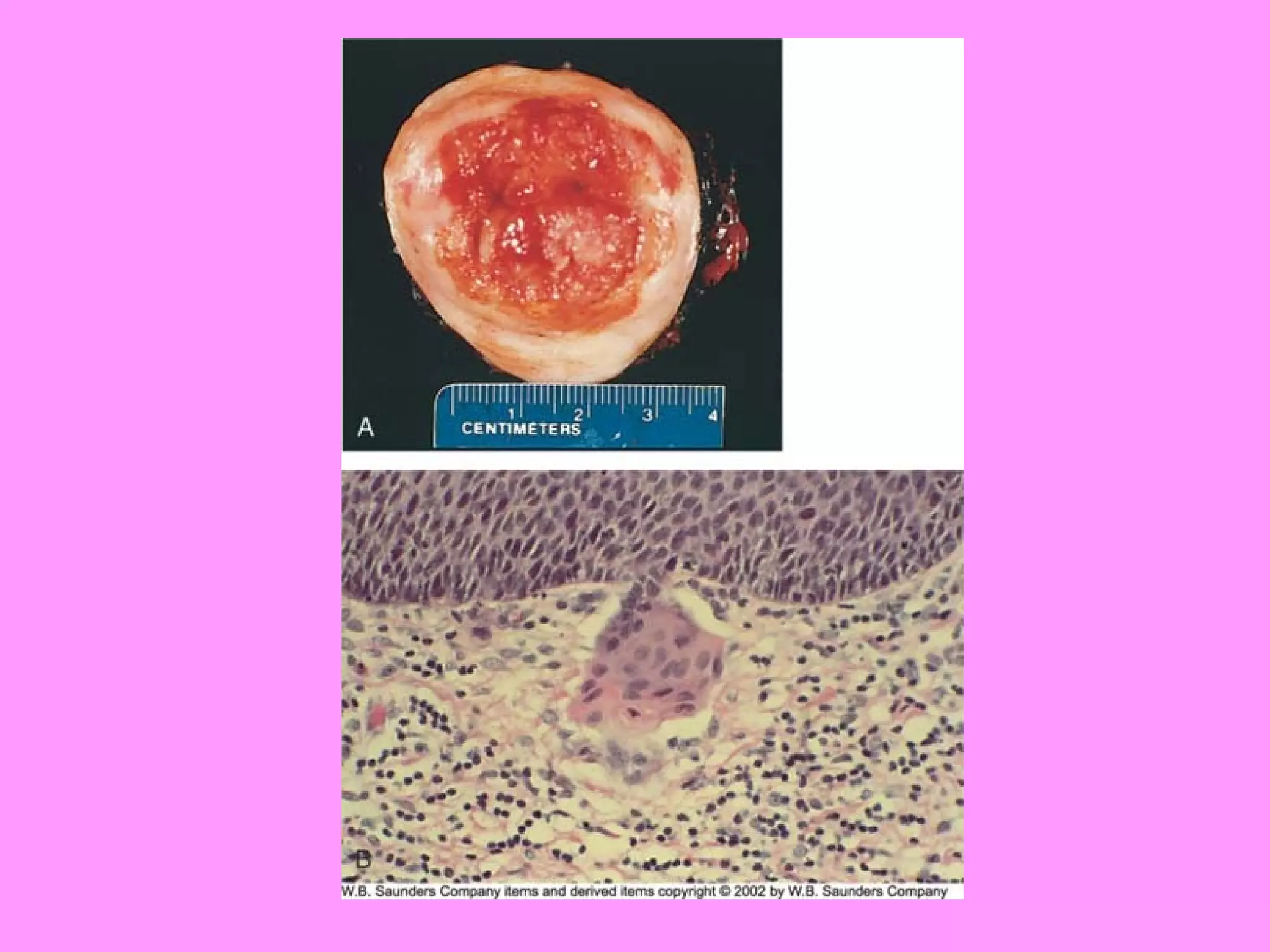 Reproductive System Disorders | PPT