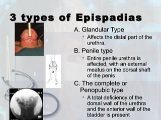 REPRODUCTIVE DISORDERS-FENWICK, FILAMER