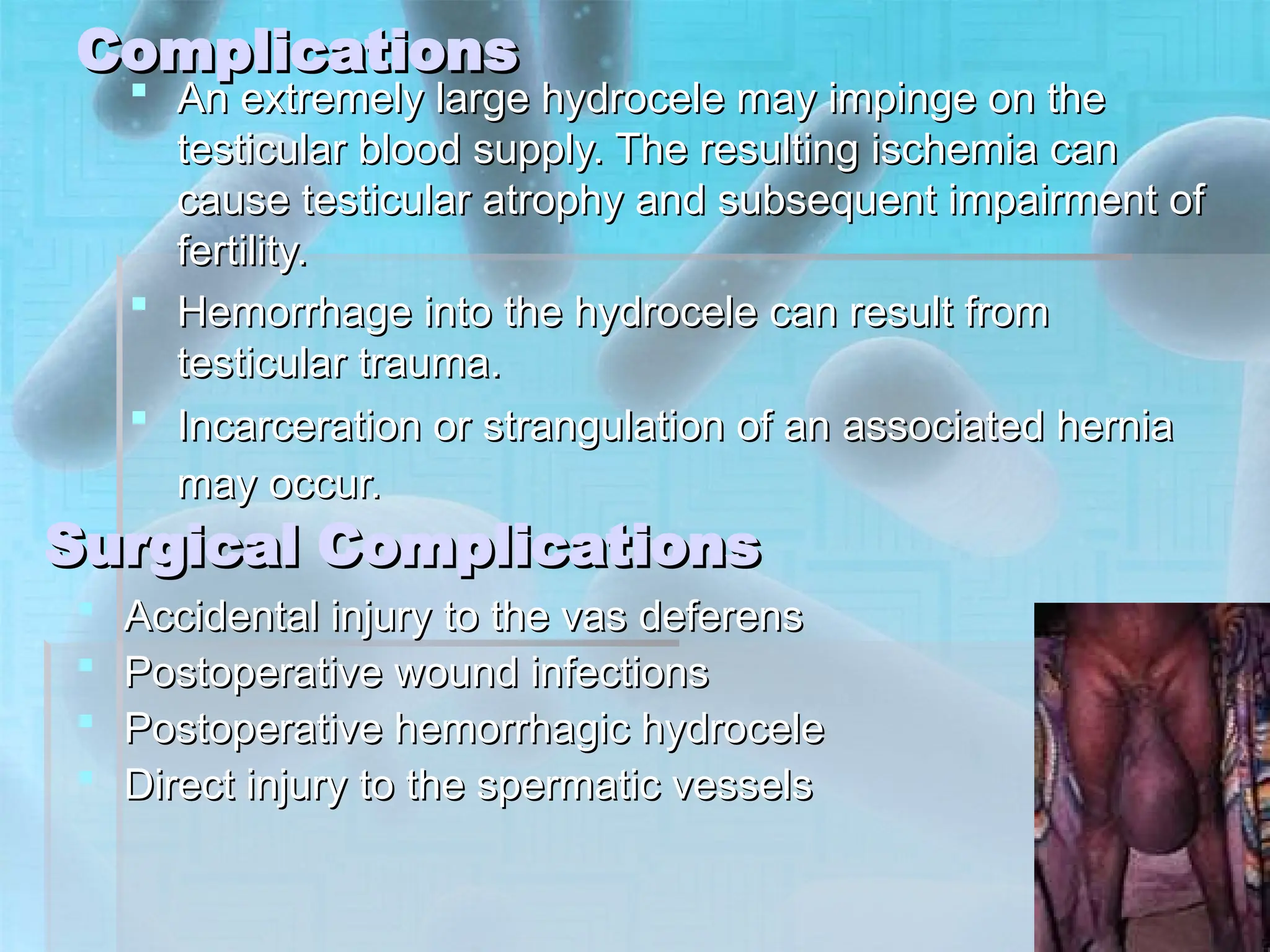 Reproductive System disorders (1).....ppt