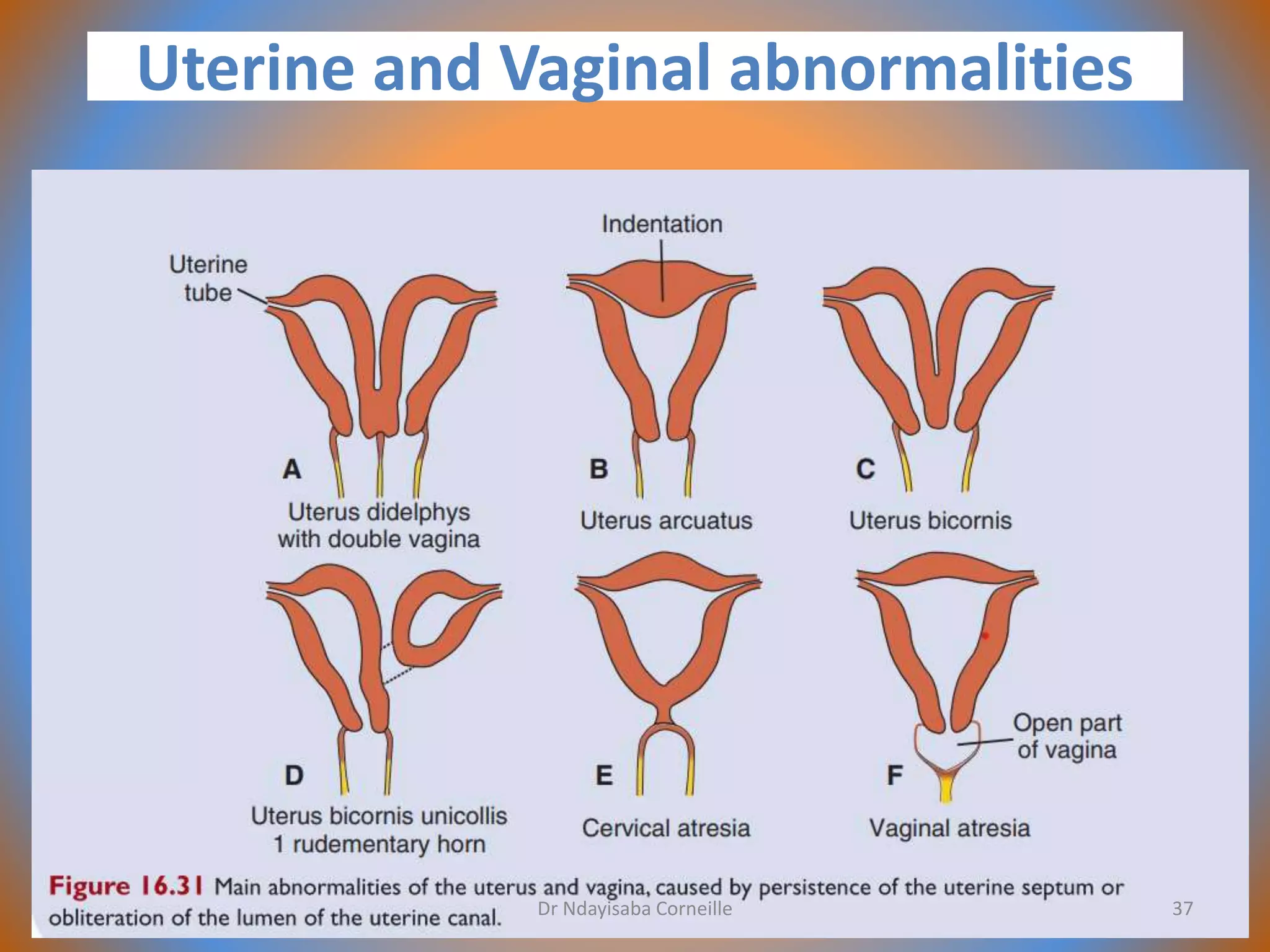 Reproductive System Embryology.pptx