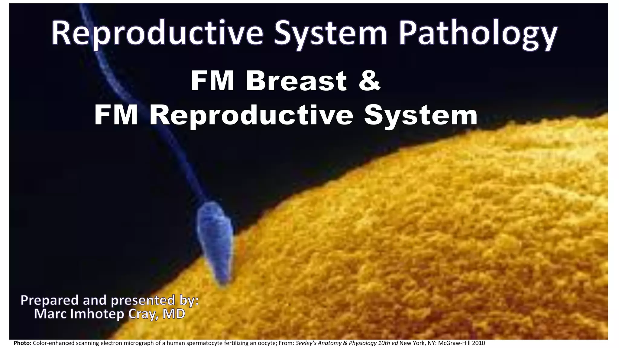 Reproductive System Pathology_FM Breast and FM Reproductive Systems | PPT