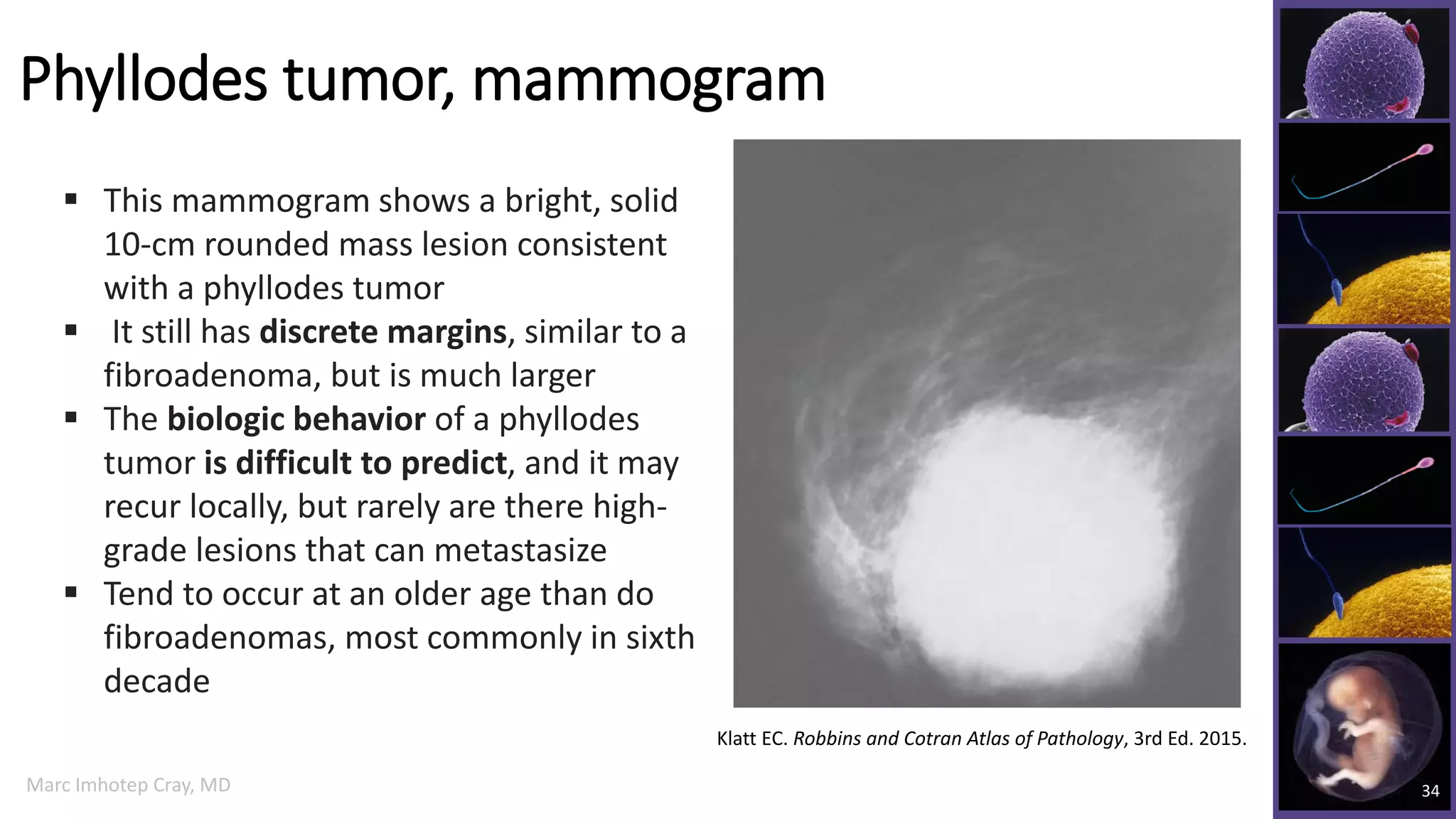 Reproductive System Pathology_FM Breast and FM Reproductive Systems | PDF