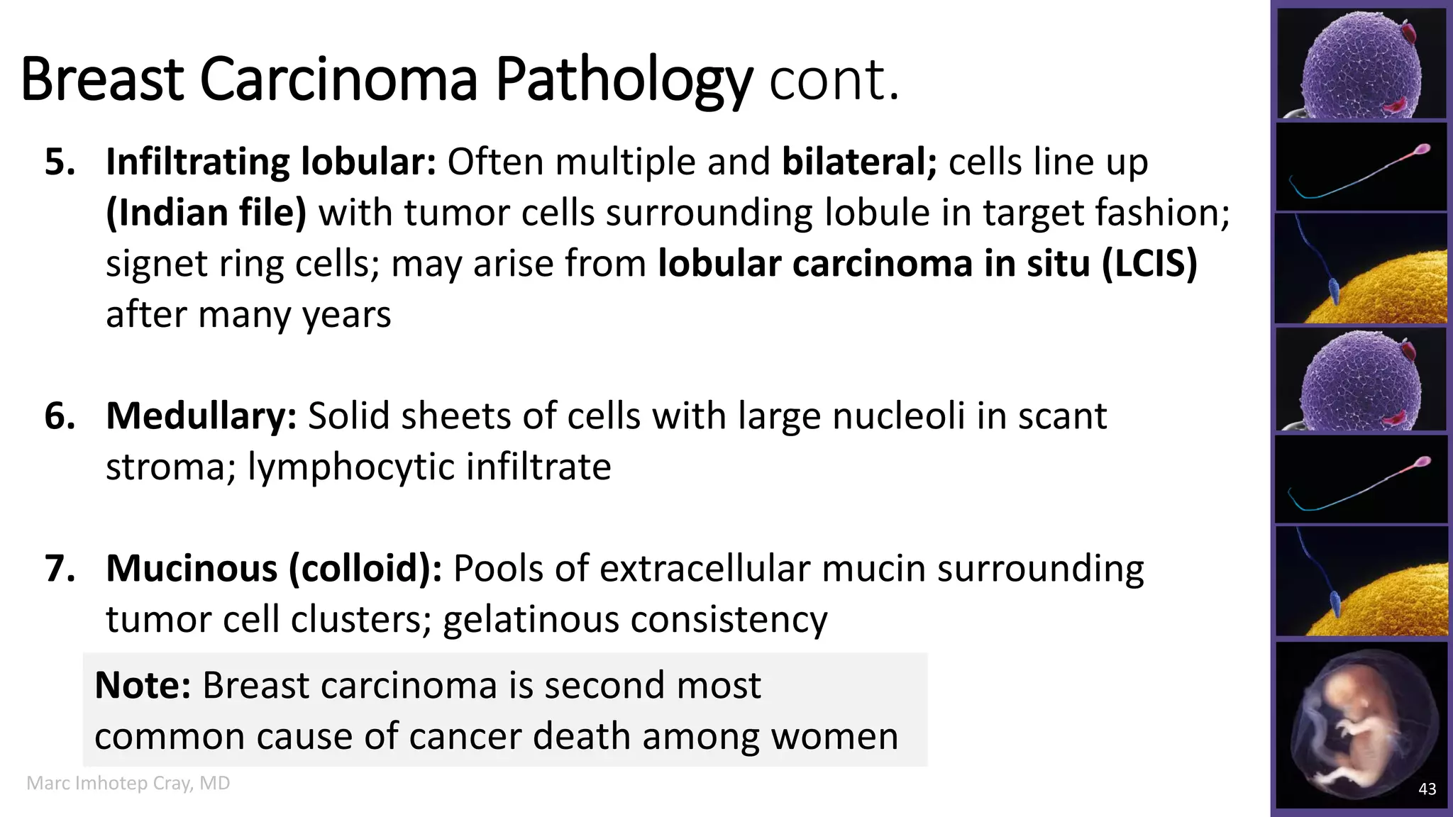 Reproductive System Pathology_FM Breast and FM Reproductive Systems | PDF