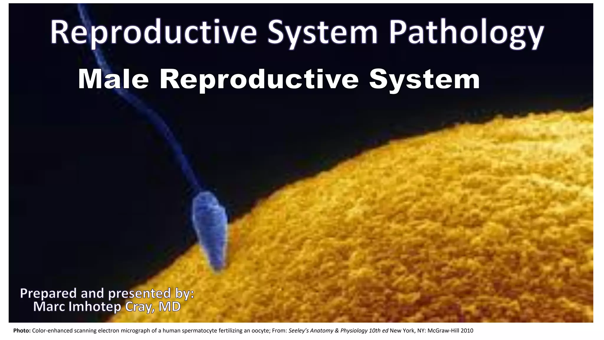 Reproductive System Pathology_Male Reproductive Systems | PDF