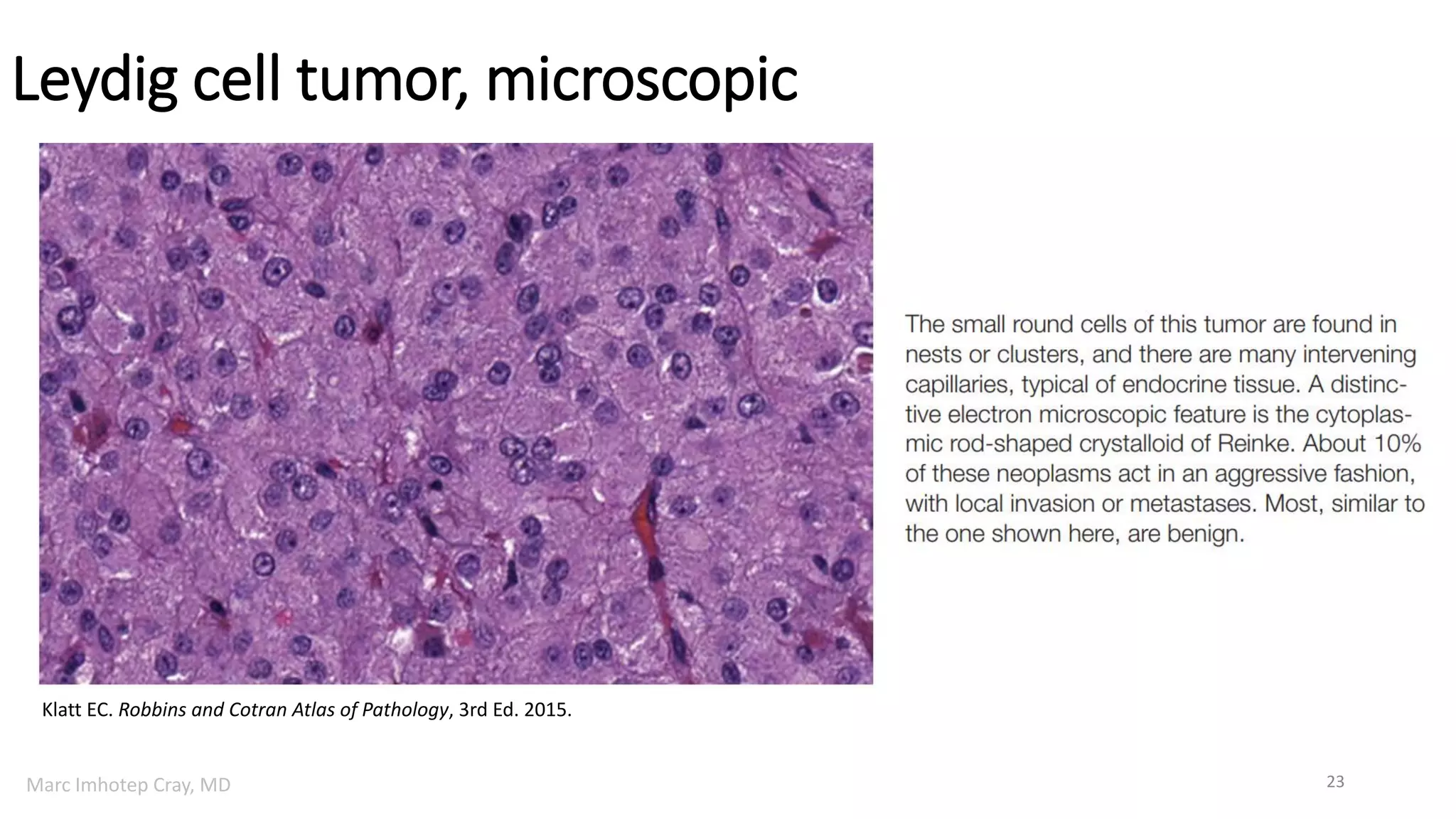 Reproductive System Pathology_Male Reproductive Systems | PDF