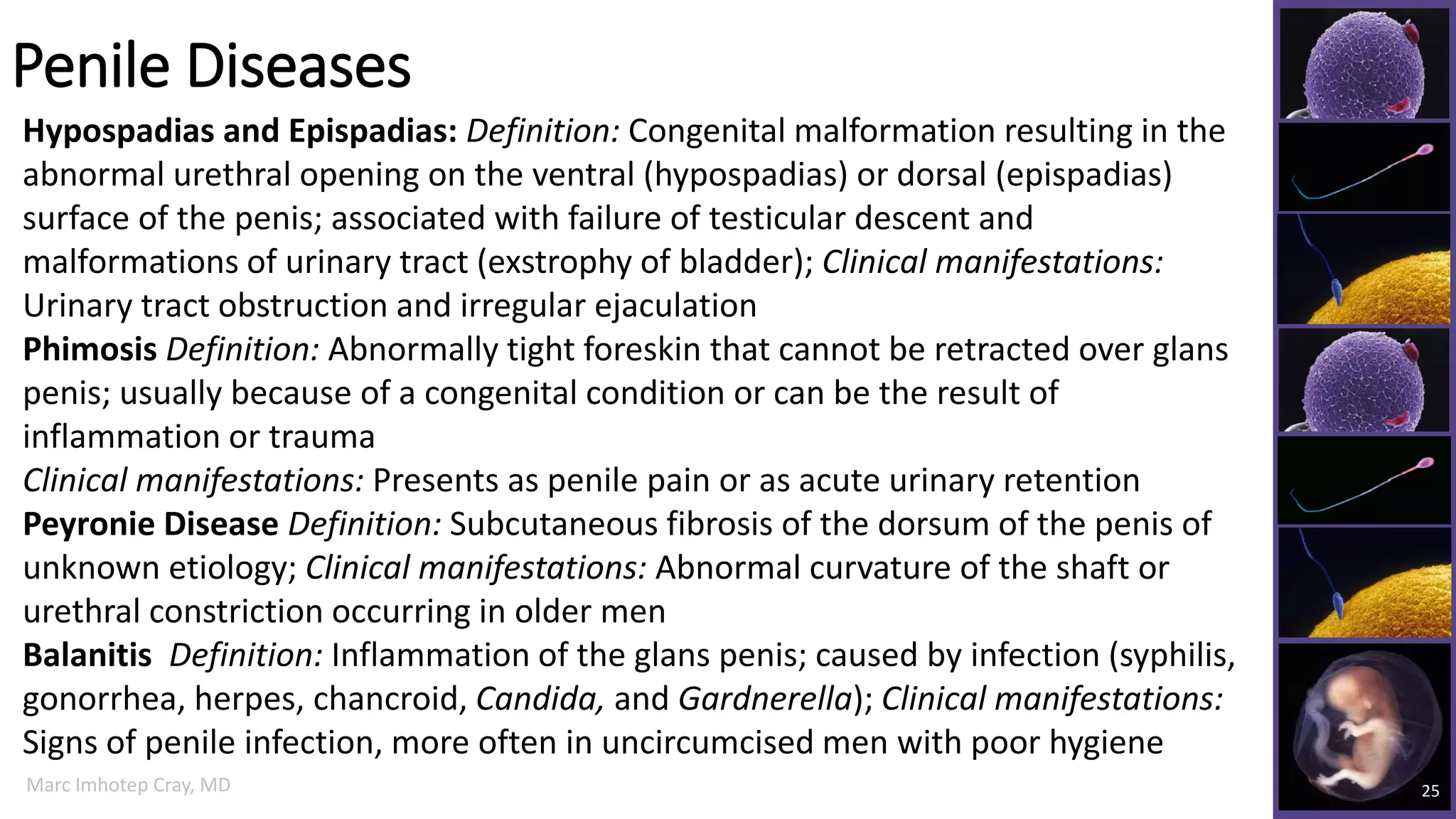 Reproductive System Pathology_Male Reproductive Systems | PDF