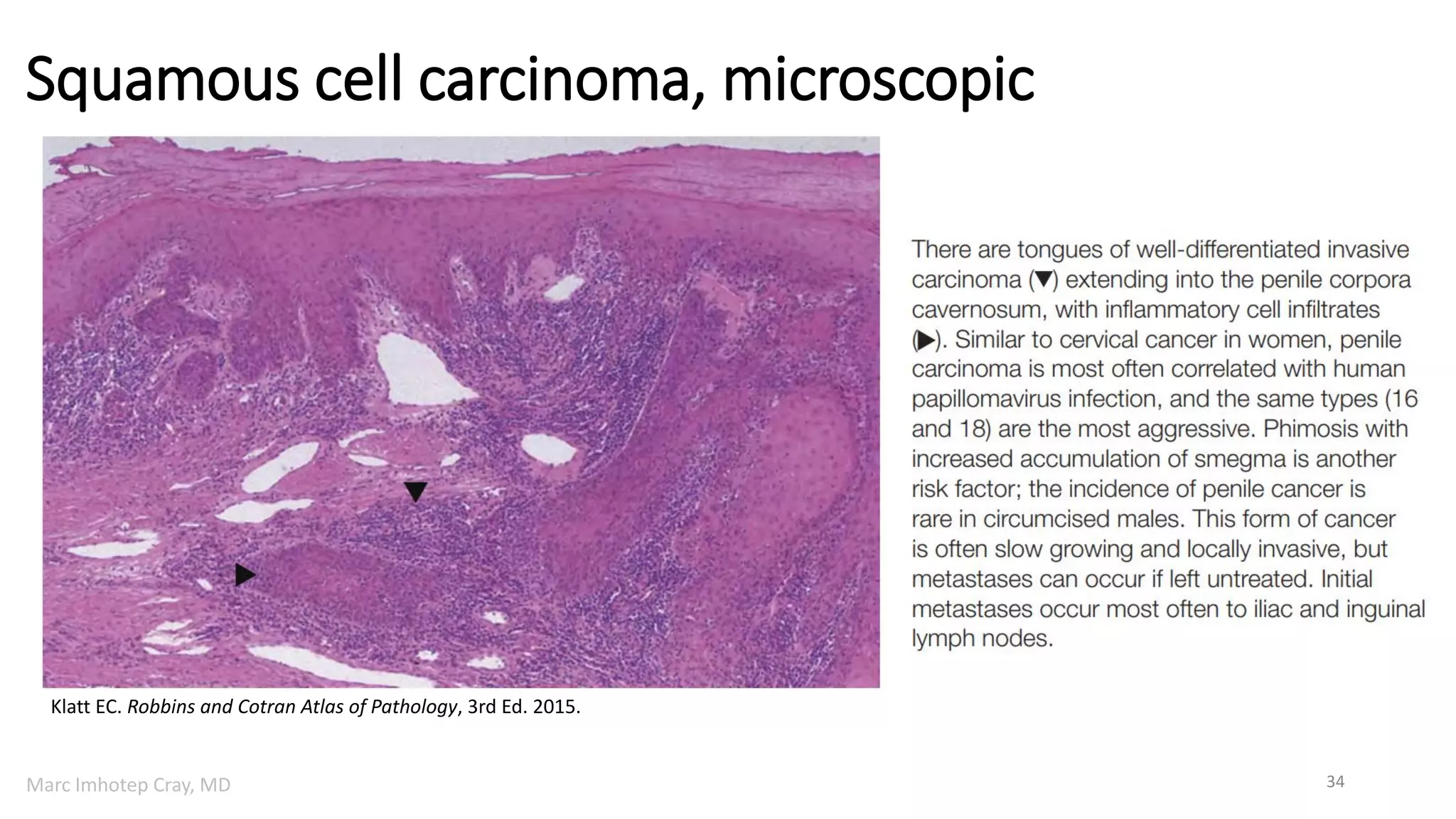 Reproductive System Pathology_Male Reproductive Systems | PDF