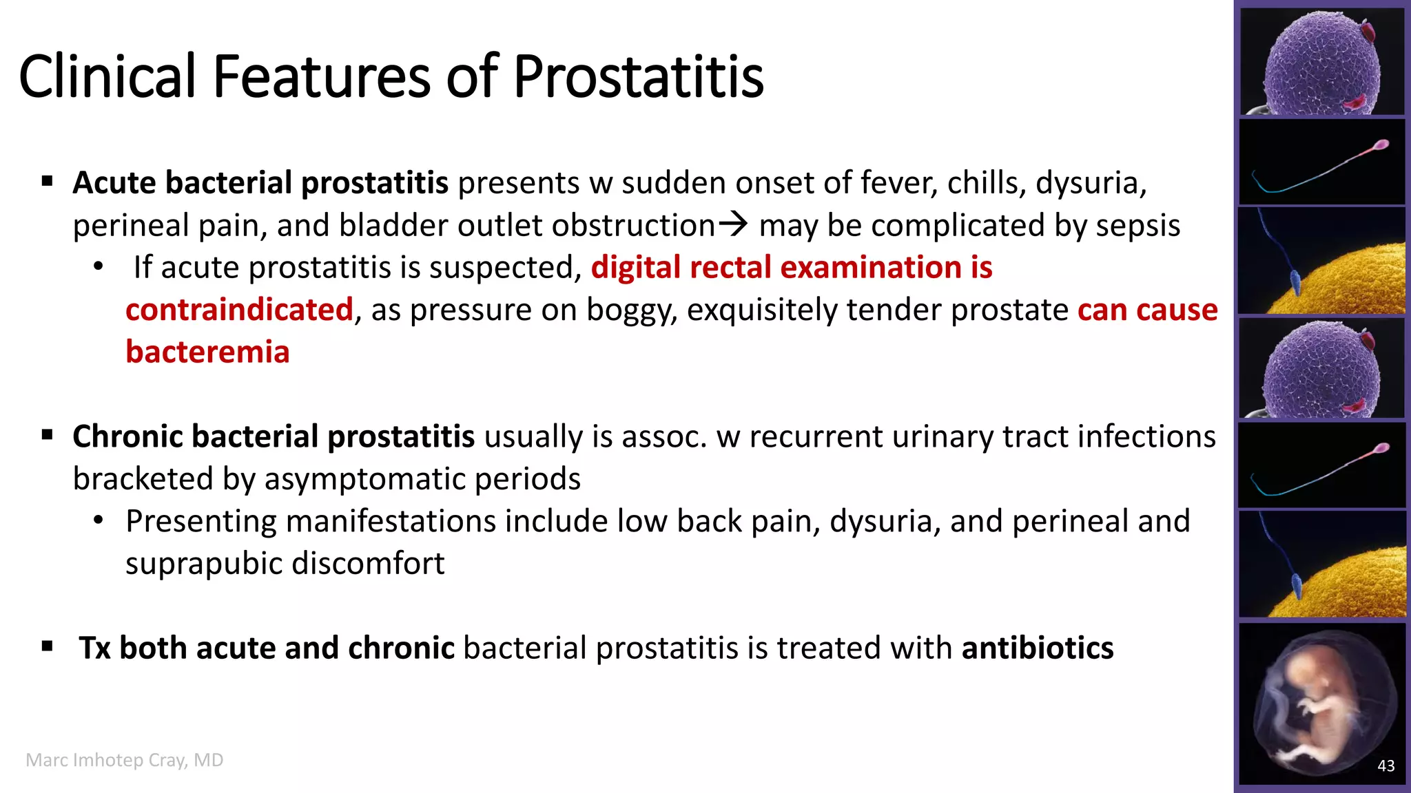 Reproductive System Pathology_Male Reproductive Systems | PDF