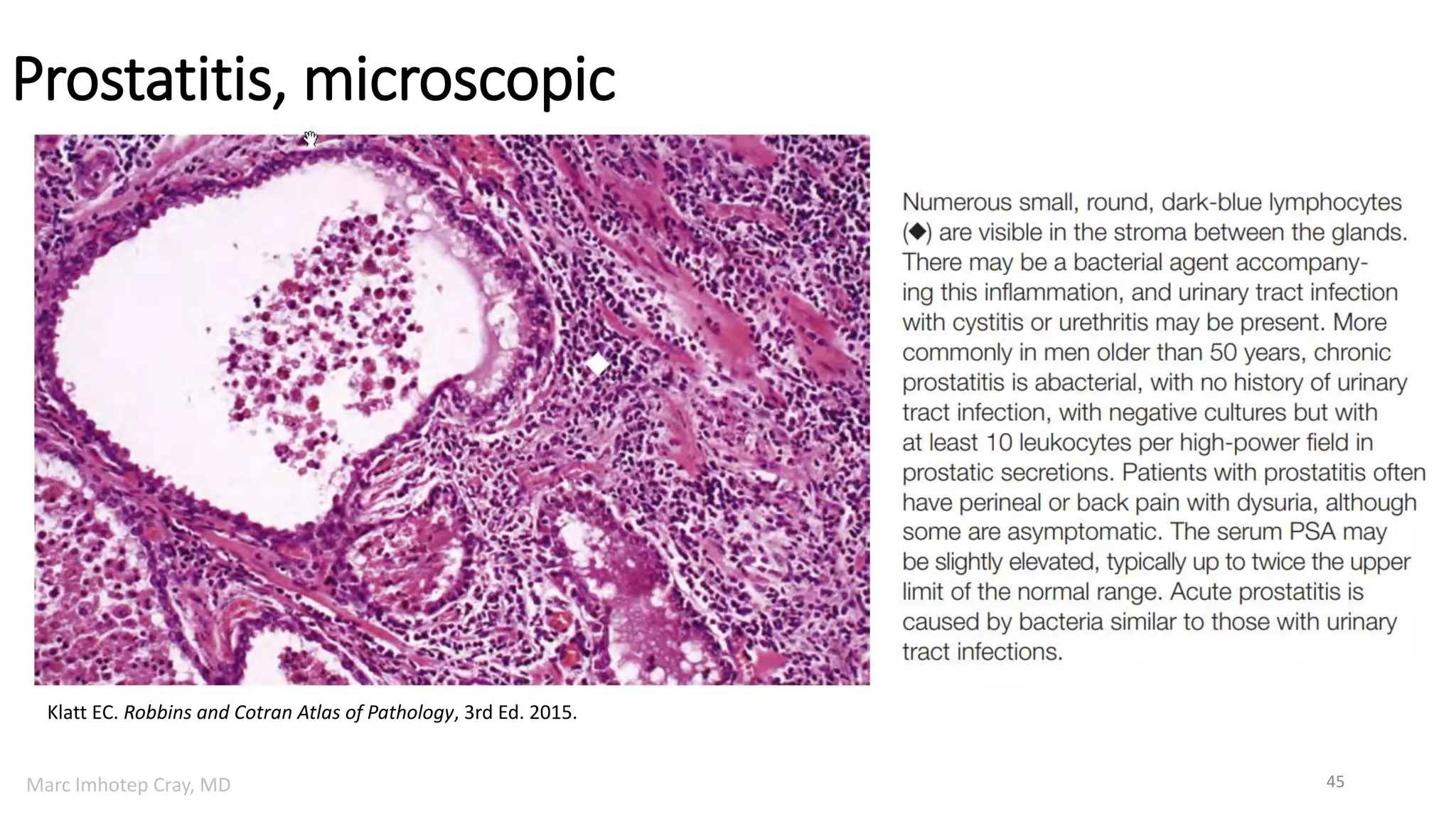 Reproductive System Pathology_Male Reproductive Systems | PDF