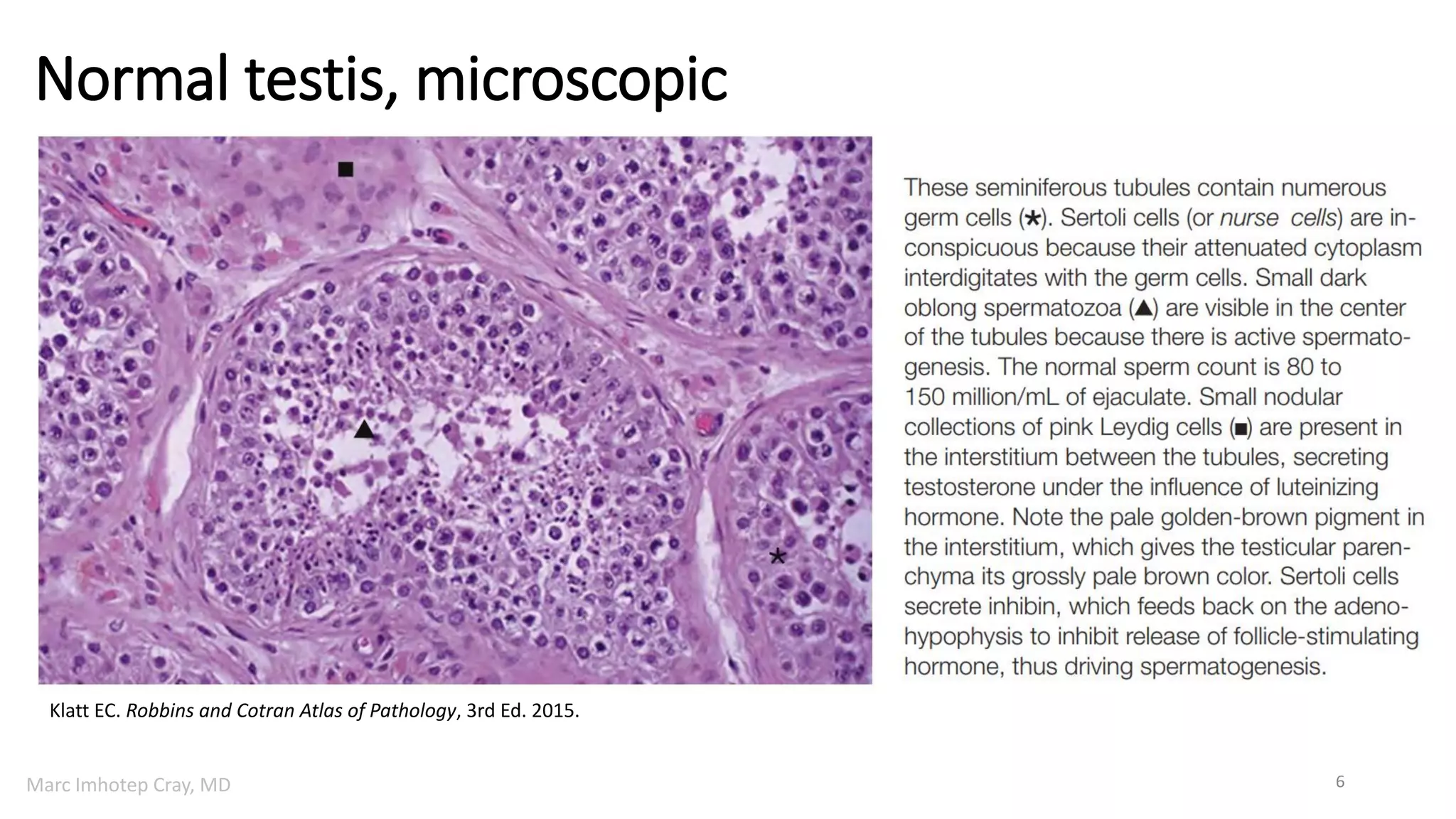 Reproductive System Pathology_Male Reproductive Systems | PDF