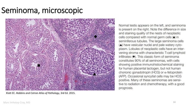 Reproductive System Pathology_Male Reproductive Systems | PDF