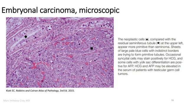 Reproductive System Pathology_Male Reproductive Systems | PDF
