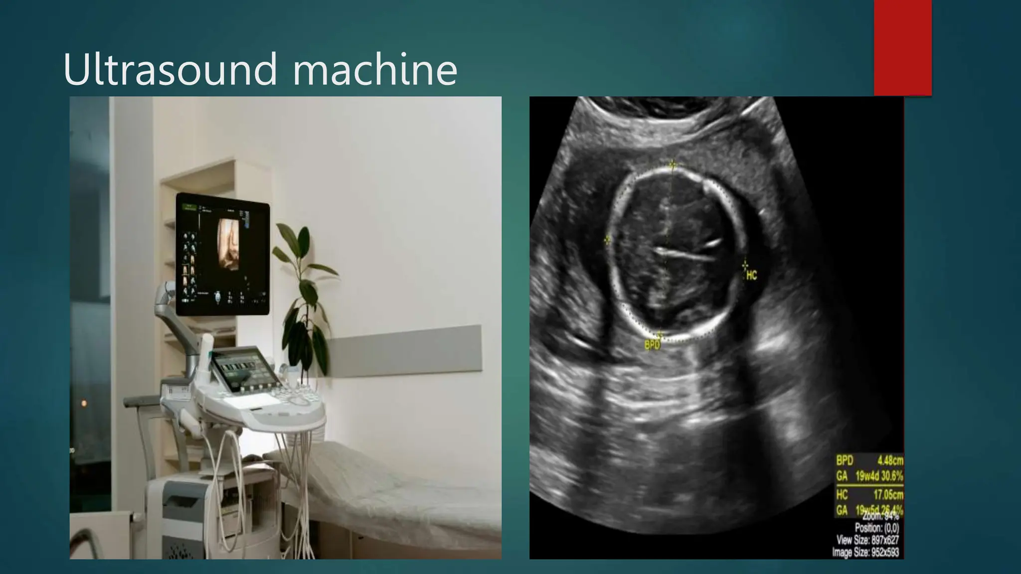 Reproductive System Ppt Pptx Radiographic Pptx