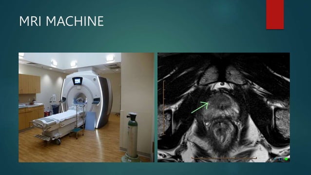REPRODUCTIVE SYSTEM PPT.pptx radiographic | PPTX | Pregnancy ...