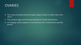 REPRODUCTIVE SYSTEM PPT.pptx radiographic | PPTX