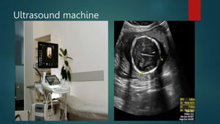 REPRODUCTIVE SYSTEM PPT.pptx radiographic | PPTX
